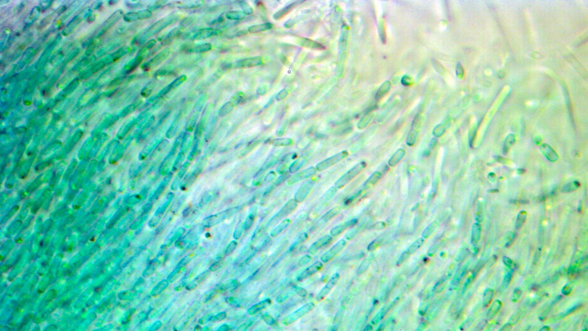 cyanobacteria under light microscope