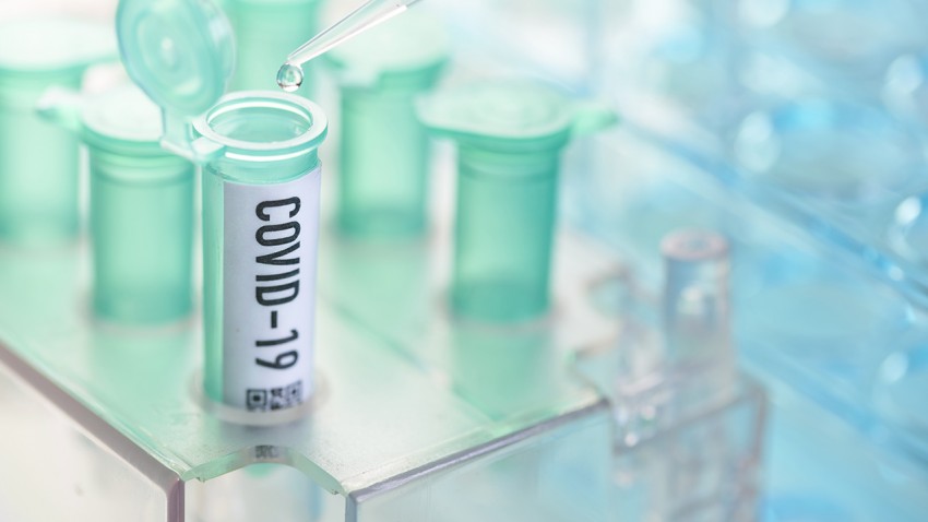 Study reveals possible new coronavirus entry points | Cornell Institute ...