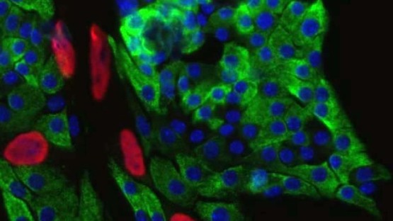 Boosting beta cells to treat Type 2 diabetes | Cornell Chronicle