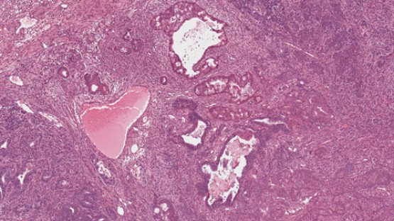 Study reveals why testicular cancer responds to chemo | Cornell Chronicle