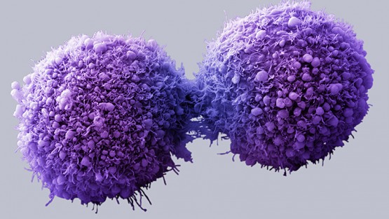 Study reveals how promising cancer drug works for best use | Cornell ...