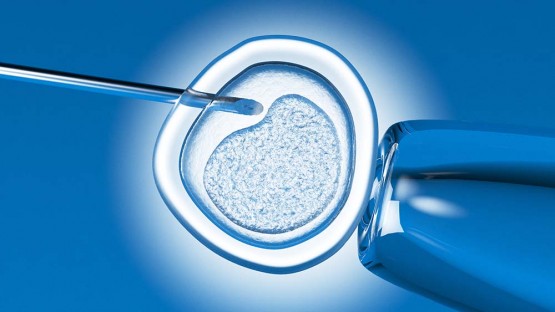 A fully automated AI-based system can assess IVF embryo quality ...