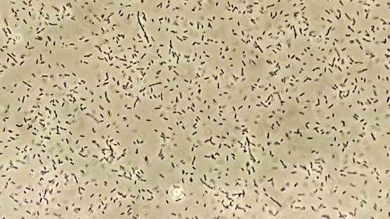 Newly found bacteria fights climate change, soil pollutants | Cornell ...