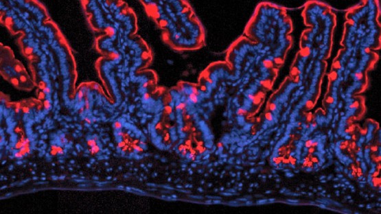 Typhoid’s relative may be key to curing disease | Cornell Chronicle