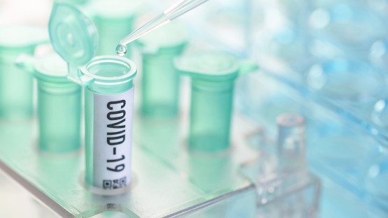 Data, testing helped Cornell curb COVID-19 | Cornell Chronicle