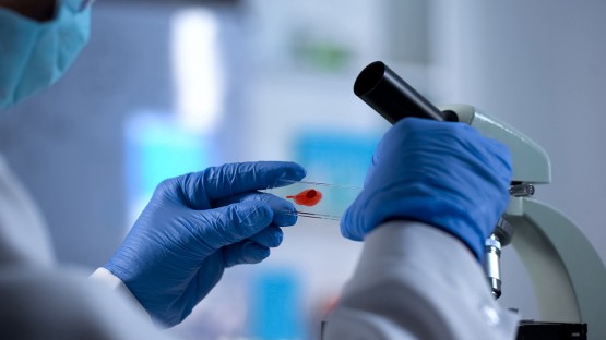 Weill Cornell awarded $28.5M grant to lead HIV cure research | Cornell ...