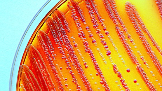Bacteria underlie success of fecal microbiota transplants | Cornell ...