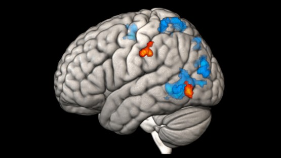 Insular cortex linked to brain stimulation’s antidepressant effects ...