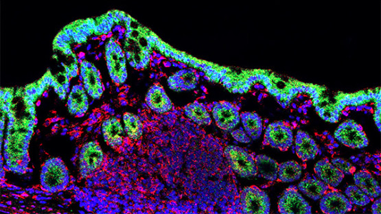 Kanvas Biosciences raises $48 million to advance microbiome cancer ...