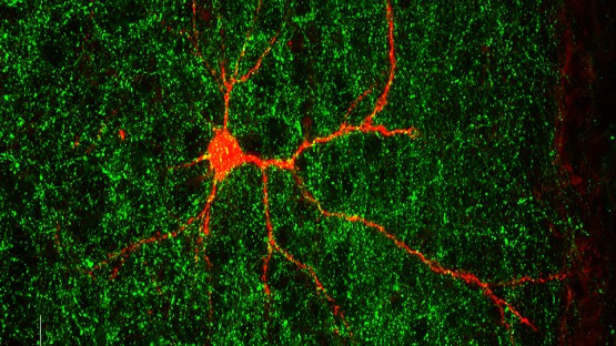 Autism-linked gene shapes nerve connections | Cornell Chronicle