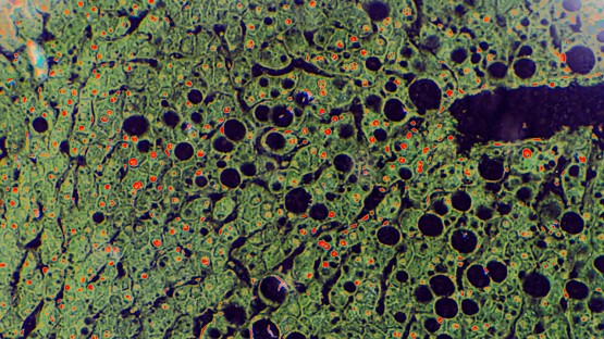 Lipid expansion microscopy uses the ‘power of click chemistry ...