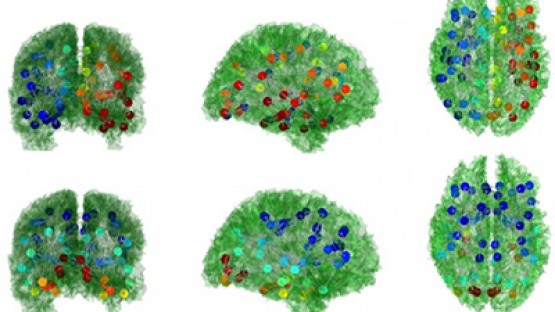 Brain's network may provide insights into neurological disorders ...
