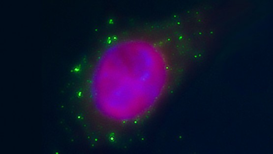 Enzyme key to triggering anti-cancer immune response | Cornell Chronicle